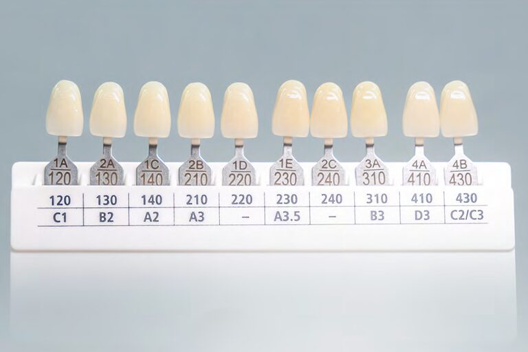 Crown Prep and Shade Matching: Getting It Right the First Time